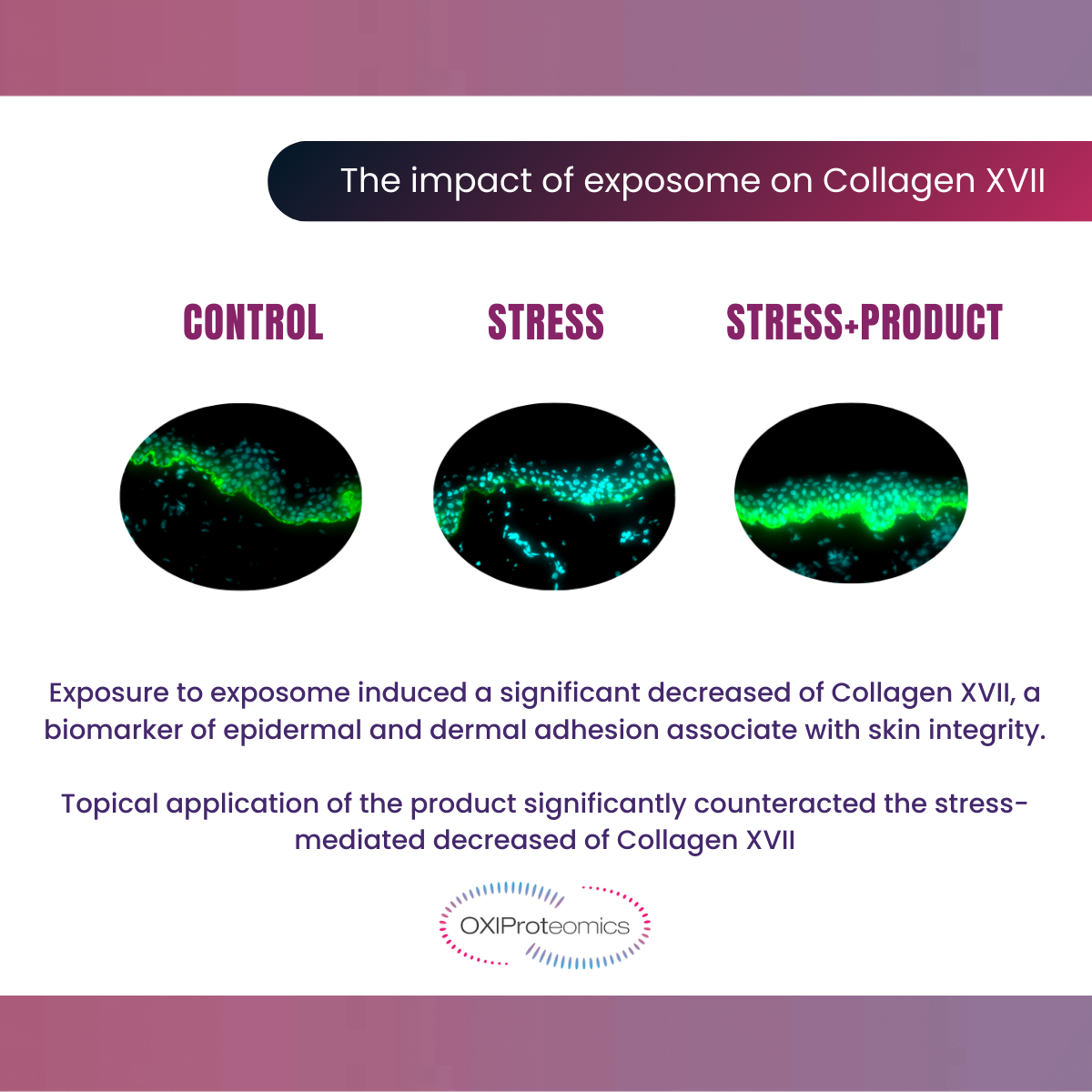 The impact of exposome on Collagen XVII - Oxiproteomics